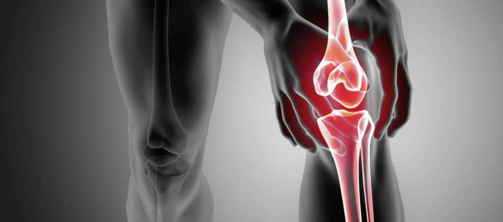 Quadriceps tendon rupture | Doctor Philippe Paillard Office