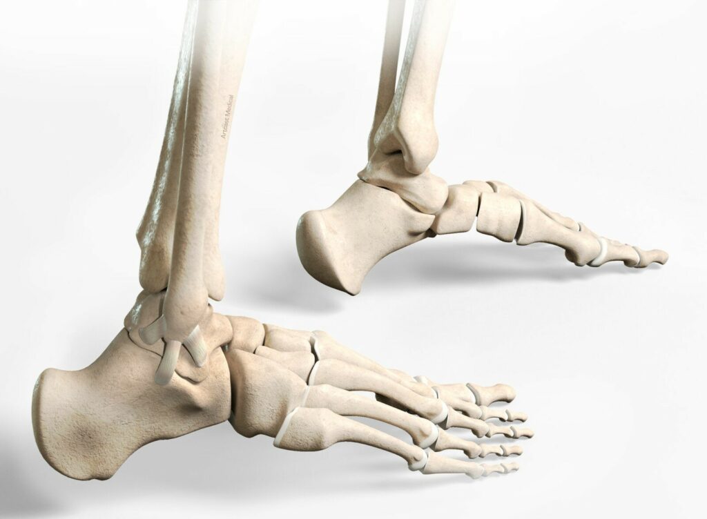 Pathologies de la cheville – Symptômes - Dr Philippe Paillard